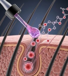 PP405 Hair Loss Treatment | Upcoming Solution for Hair Regrowth